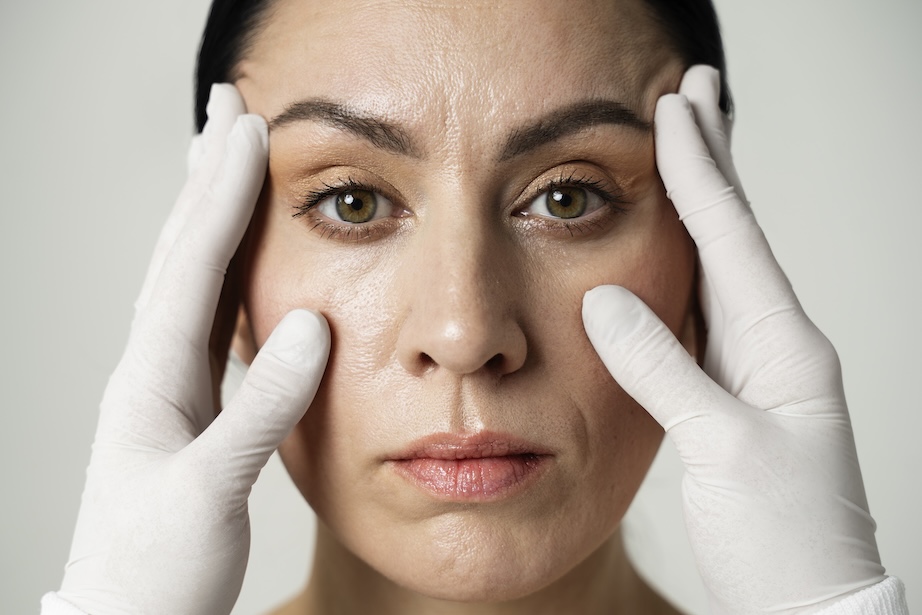 When Is a Facelift the Best Solution for Facial Rejuvenation? - Woman ...